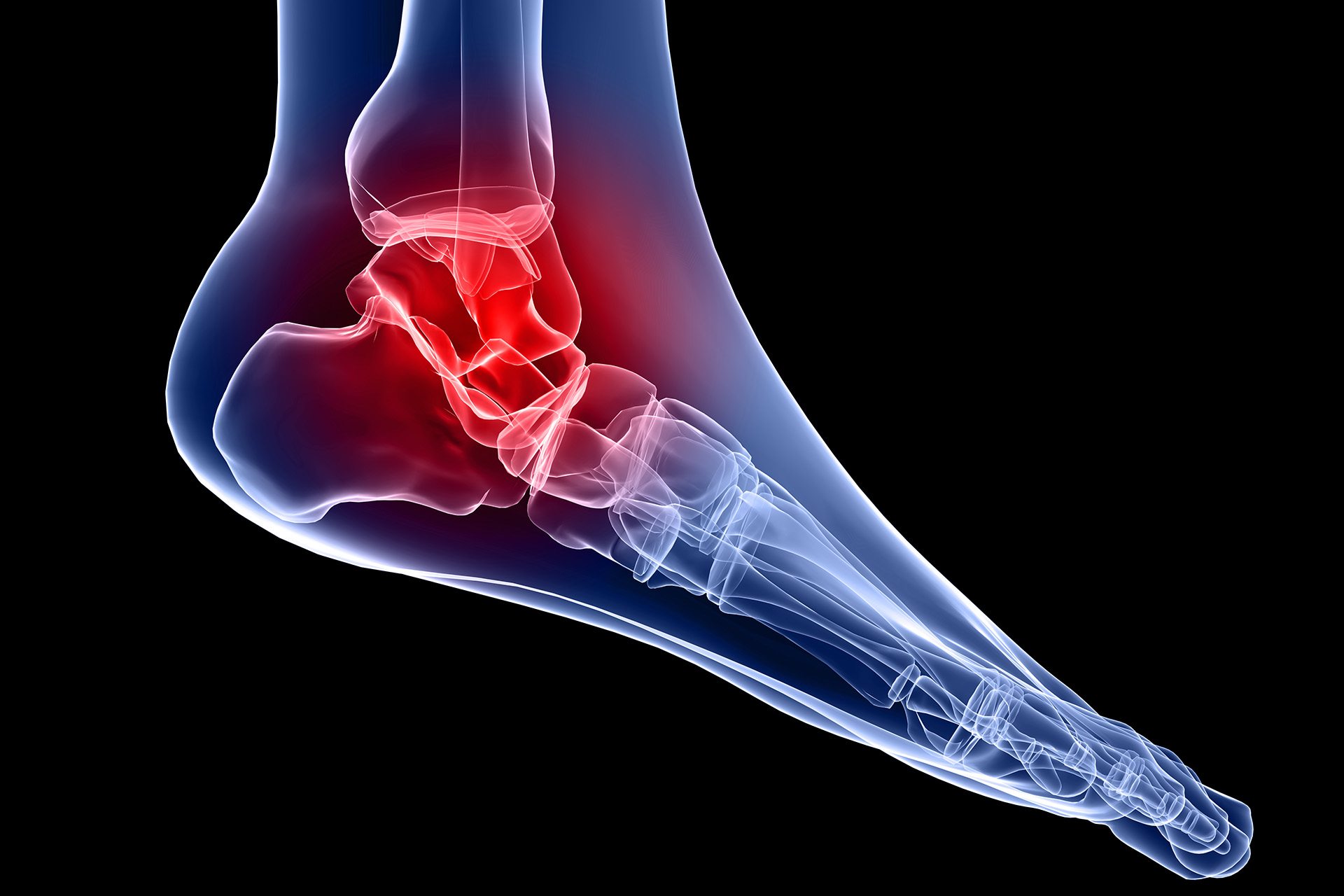 La importancia crítica del tobillo en BJJ