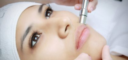 Beneficios de la microdermoabrasión