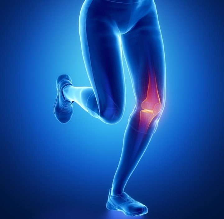 Conoce las 7 lesiones más comunes en deportistas