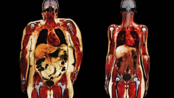Cómo mejorar tu composición corporal de acuerdo a la ciencia