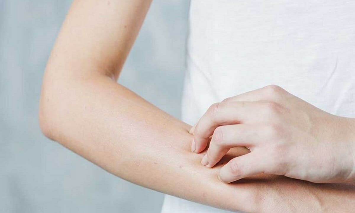 Qué es la esclerodermia: la enfermedad de la piel dura